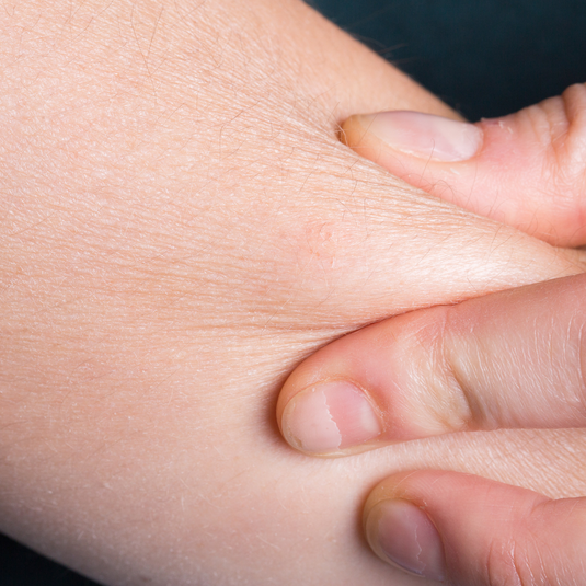 OUR EXPERTISE – Topicrem