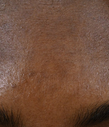 Sérum anti tache et hyperpigmentation MELA – Topicrem